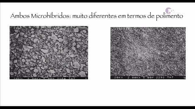Ident IA - Qual a diferença entre resina microhíbrida, nano-híbrida e...