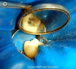 Bio 47 Sessão Única, Caso clínico | iDent