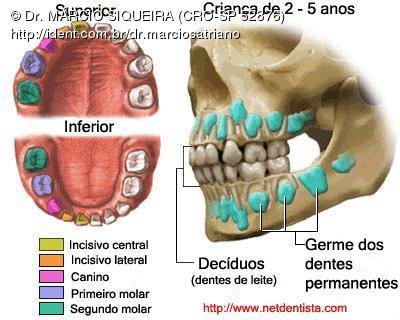 Dentíção Decidua, Artigo | Ident